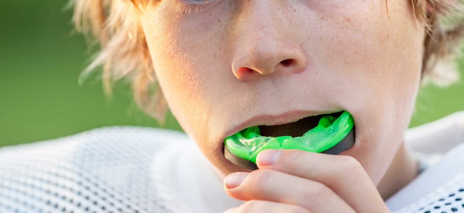 Mouth Guards | Kenmore, WA | Kenmore Pediatric Dentistry