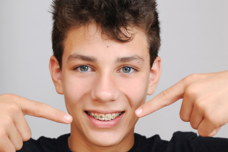 5 Tips for Taking Care of Teeth with Braces - Kenmore Pediatric Dentistry