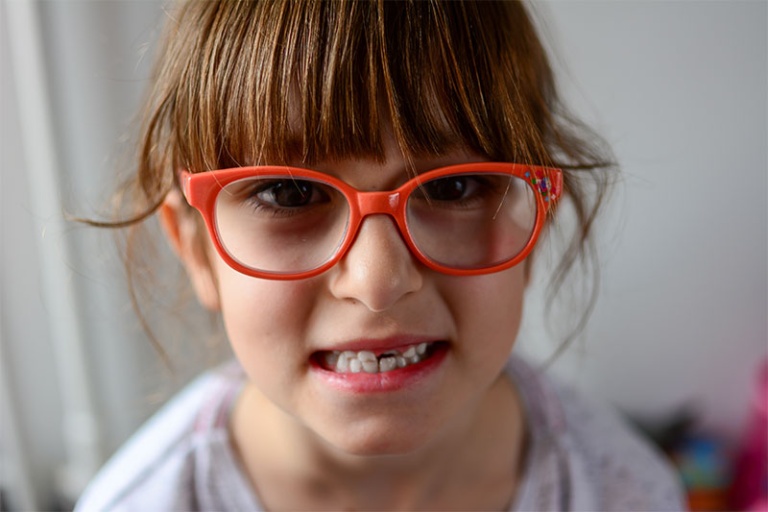 How to Handle Six-Year-Old Molars | Kenmore, WA | Kenmore Pediatric ...